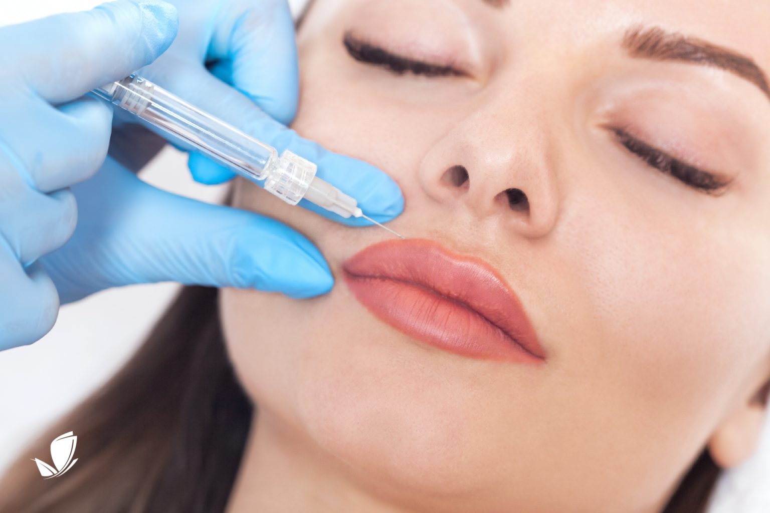 How Long Do Lip Fillers Last? | LightRx